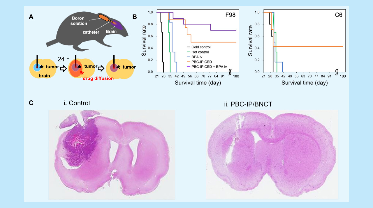Efficient Boron Neutron Capture Therapy for Brain Tumor with Novel ...